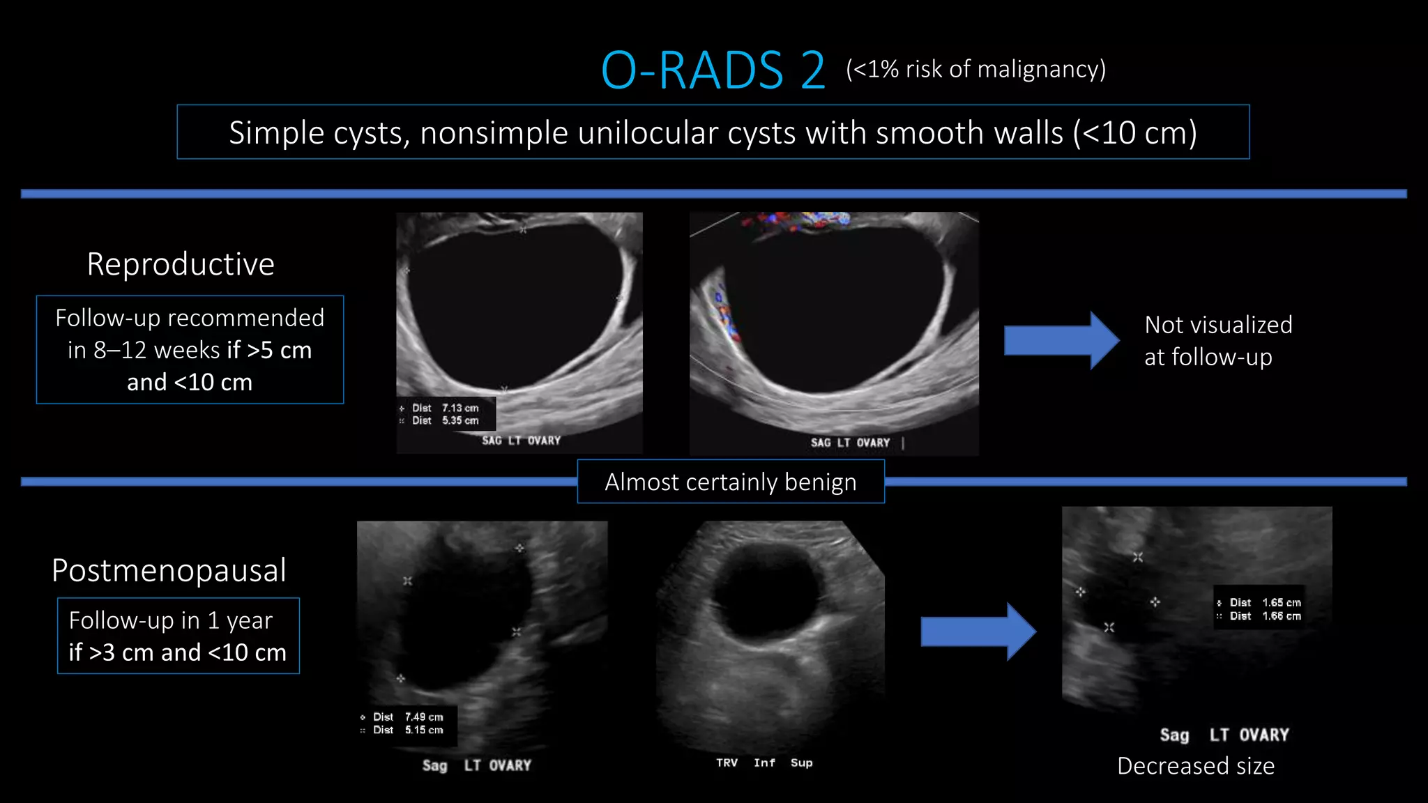 Adnexal cysts.pptx
