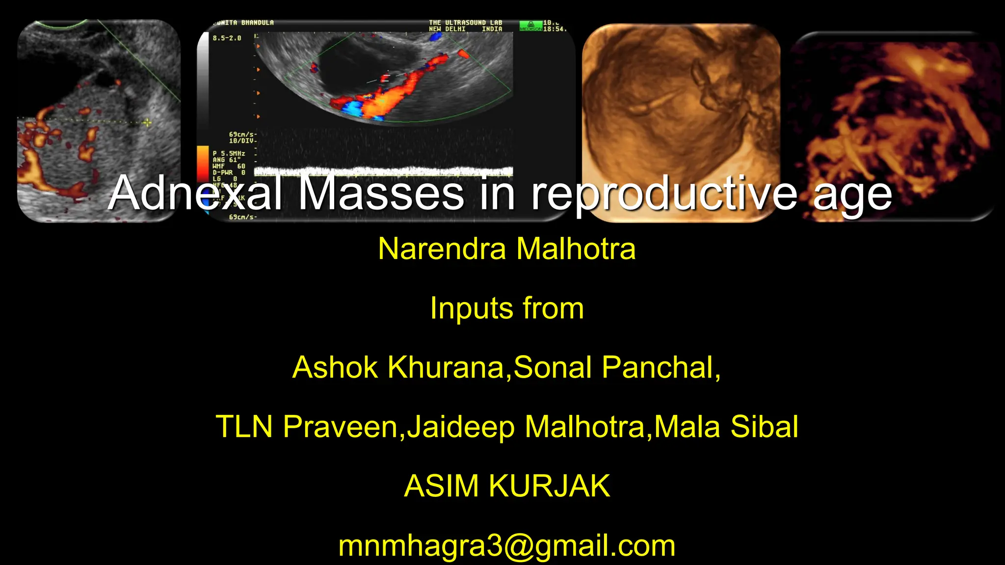 Adnexal Masses in Reproductive Age | PPT