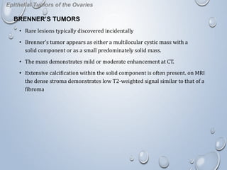 Adnexal masses | PPTX