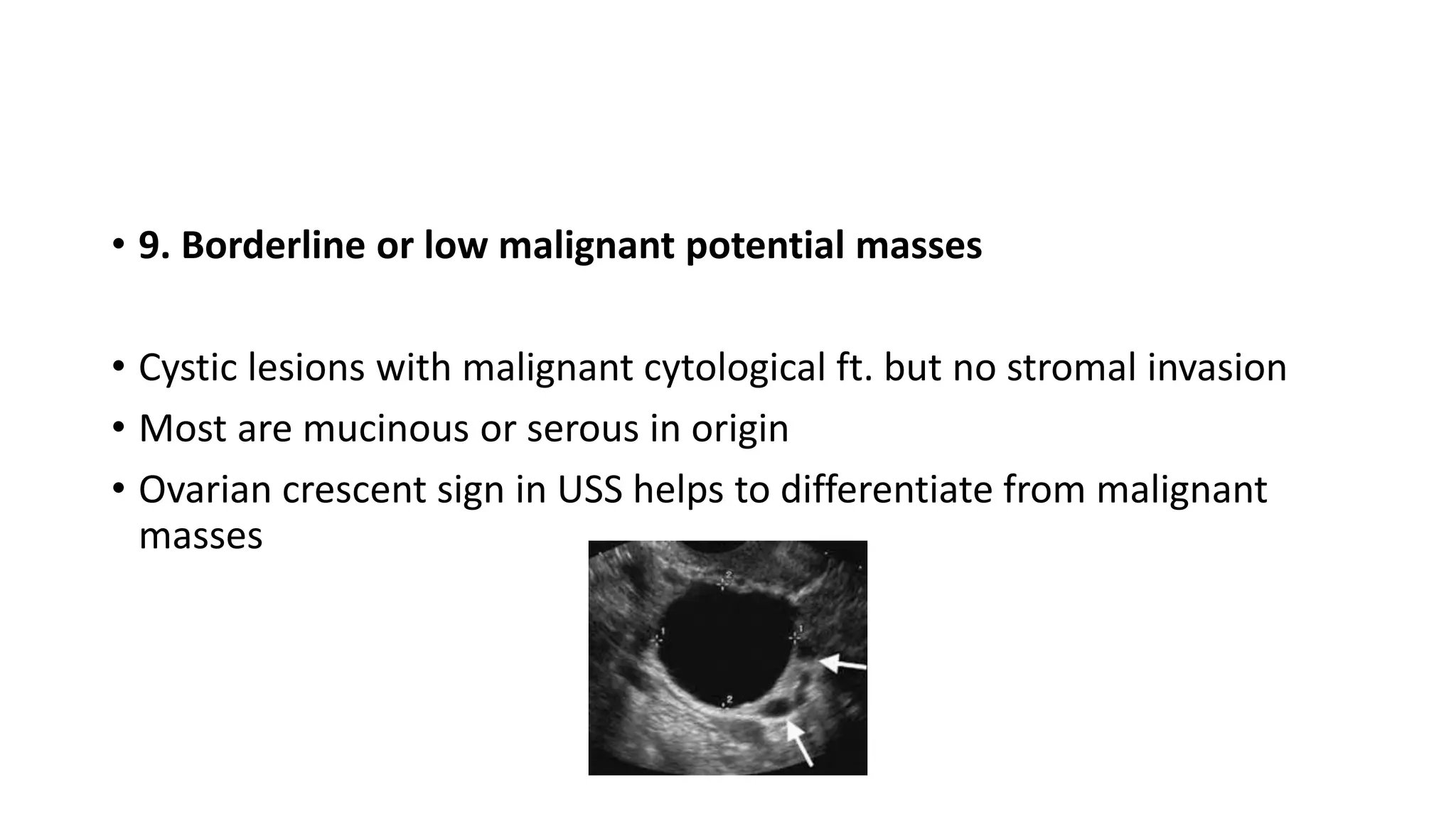 Adnexal Masses In Pregnancy Ppt