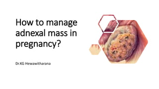 Adnexal masses in pregnancy | PPTX