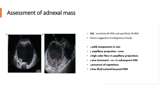 Adnexal masses in pregnancy | PPTX | Pregnancy | Reproductive Health