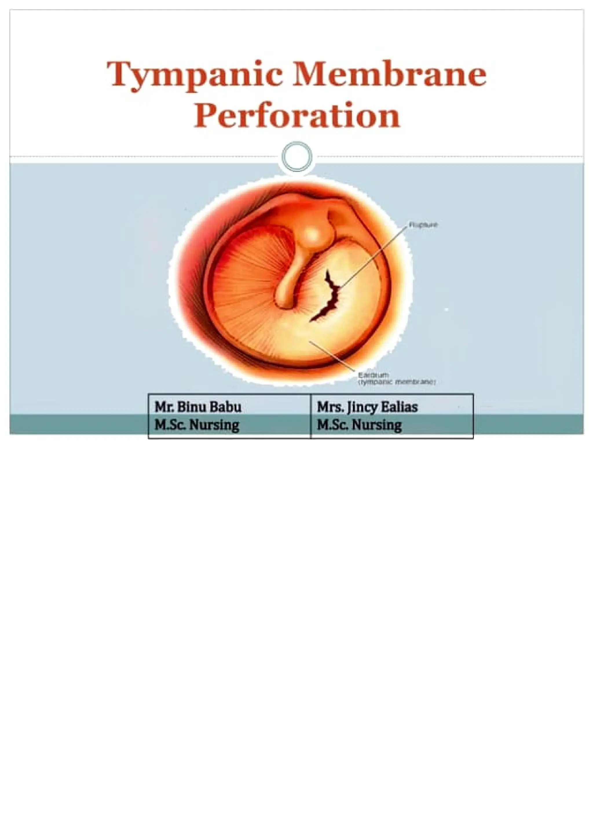 Tympanic membrane perforation seminar pdf.! | PDF
