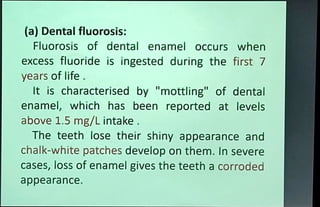 Endemic flurosis of cmfm subject very imp | PDF