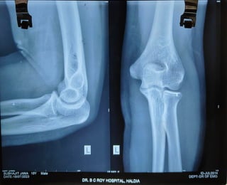 Adobe Scan 29 Jan 2024 x-rays elbow joint (1).pdf