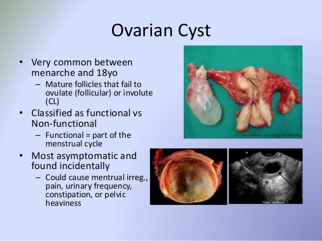 Adolescent gynecology ucaya