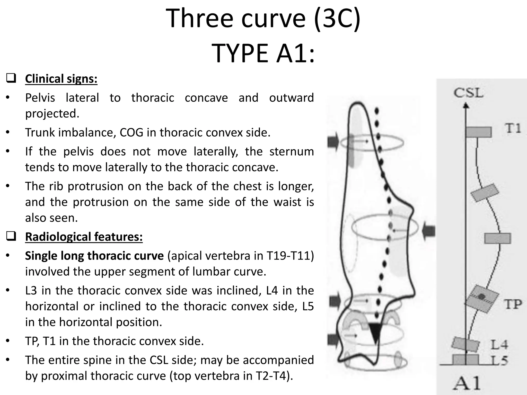 ADOLESCENT IDIOPATHIC SCOLIOSIS AND ITS ORTHOTICS MANAGEMENT.pptx