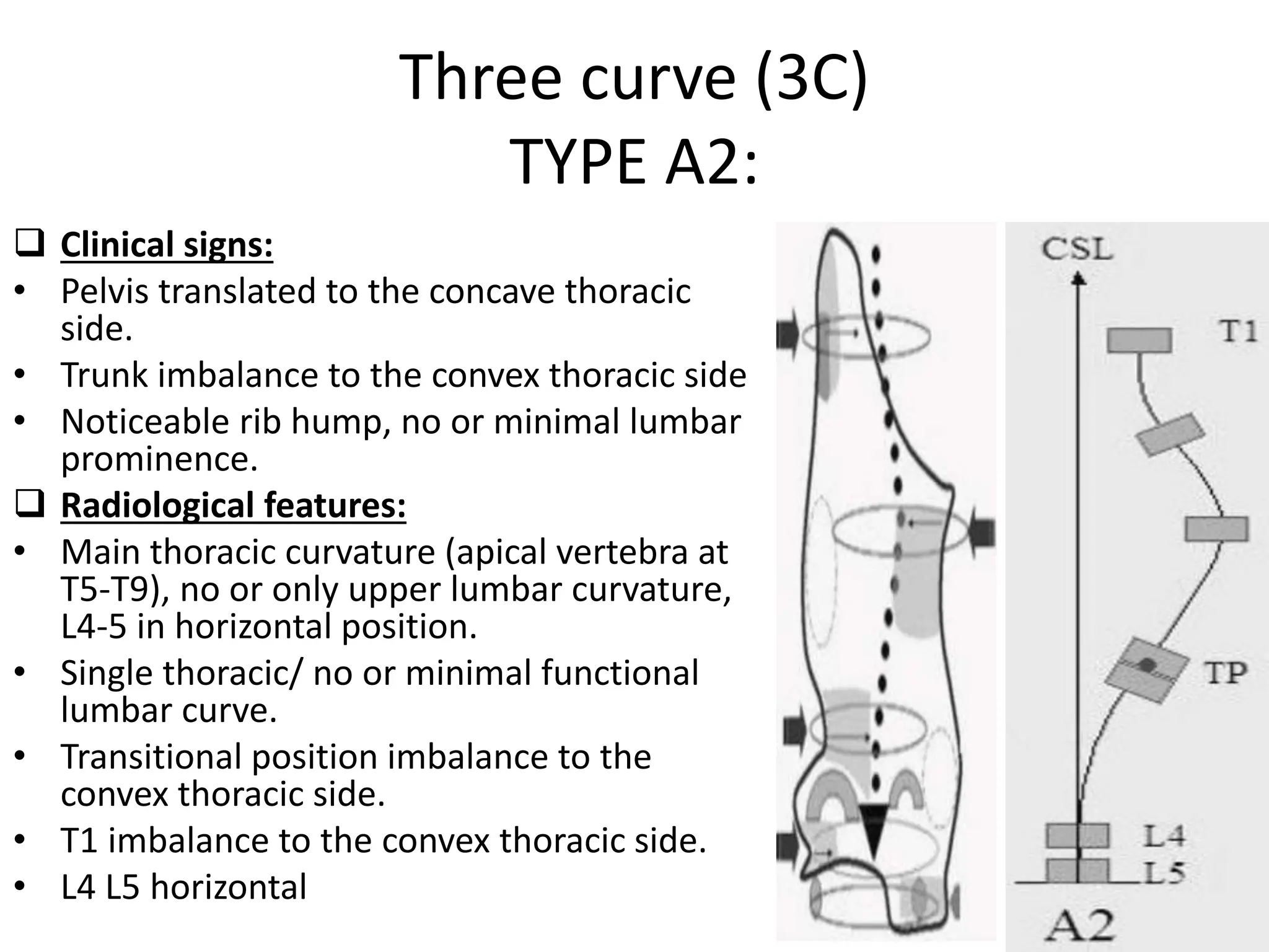 ADOLESCENT IDIOPATHIC SCOLIOSIS AND ITS ORTHOTICS MANAGEMENT.pptx