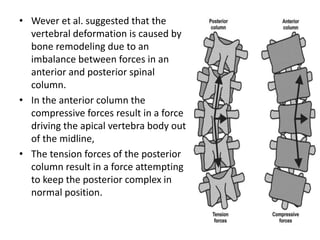 ADOLESCENT IDIOPATHIC SCOLIOSIS AND ITS ORTHOTICS MANAGEMENT.pptx