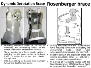 ADOLESCENT IDIOPATHIC SCOLIOSIS AND ITS ORTHOTICS MANAGEMENT.pptx