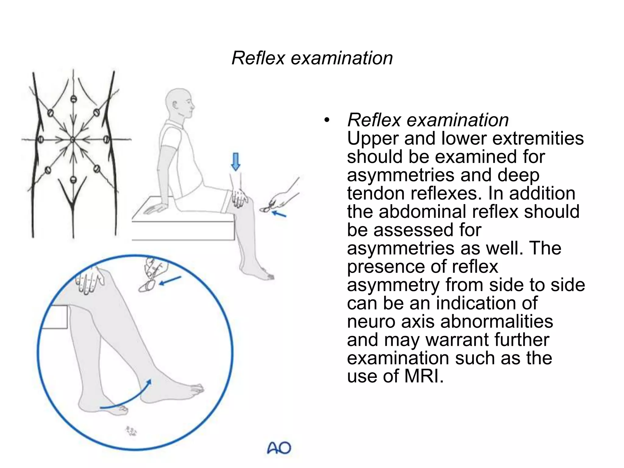 Adolescent idiopathic scoliosis patient examination | PPTX
