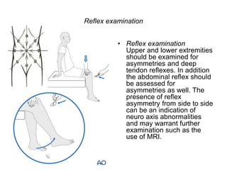 Adolescent idiopathic scoliosis patient examination | PPTX