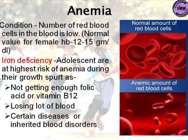 Adolescent onset anemia new | PPTX