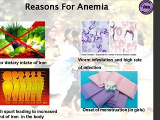 Adolescent onset anemia new | PPTX