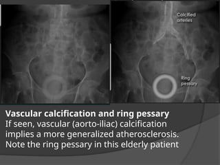 ADOMINAL IMAGING 1.pptx presentation for master | PPTX