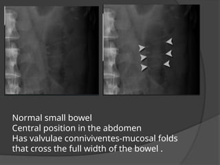 ADOMINAL IMAGING 1.pptx presentation for master | PPTX