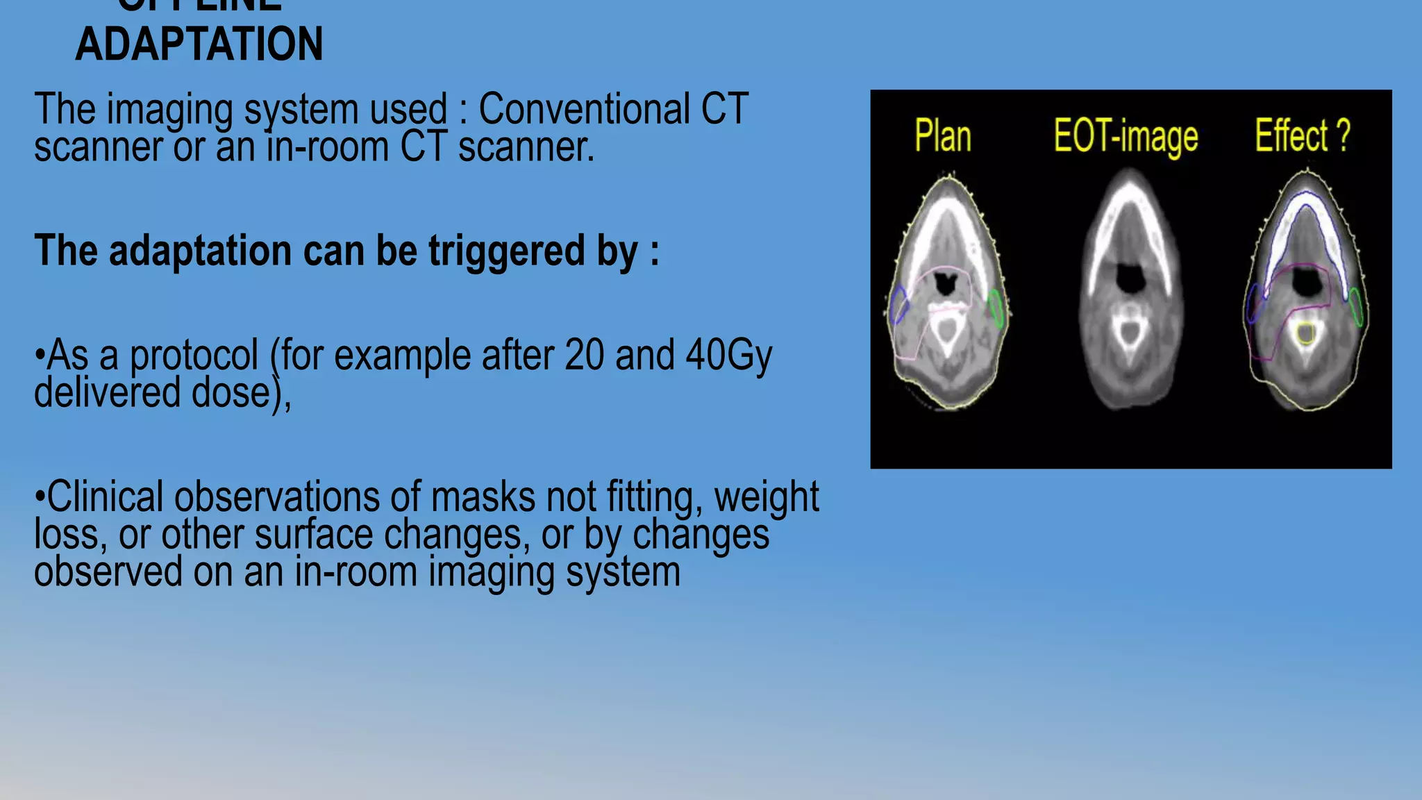 COMPLETE OVERVIEW ON ADAPTIVE RADIOTHERAPY OVER DAILY IMAGE GUIDED ...