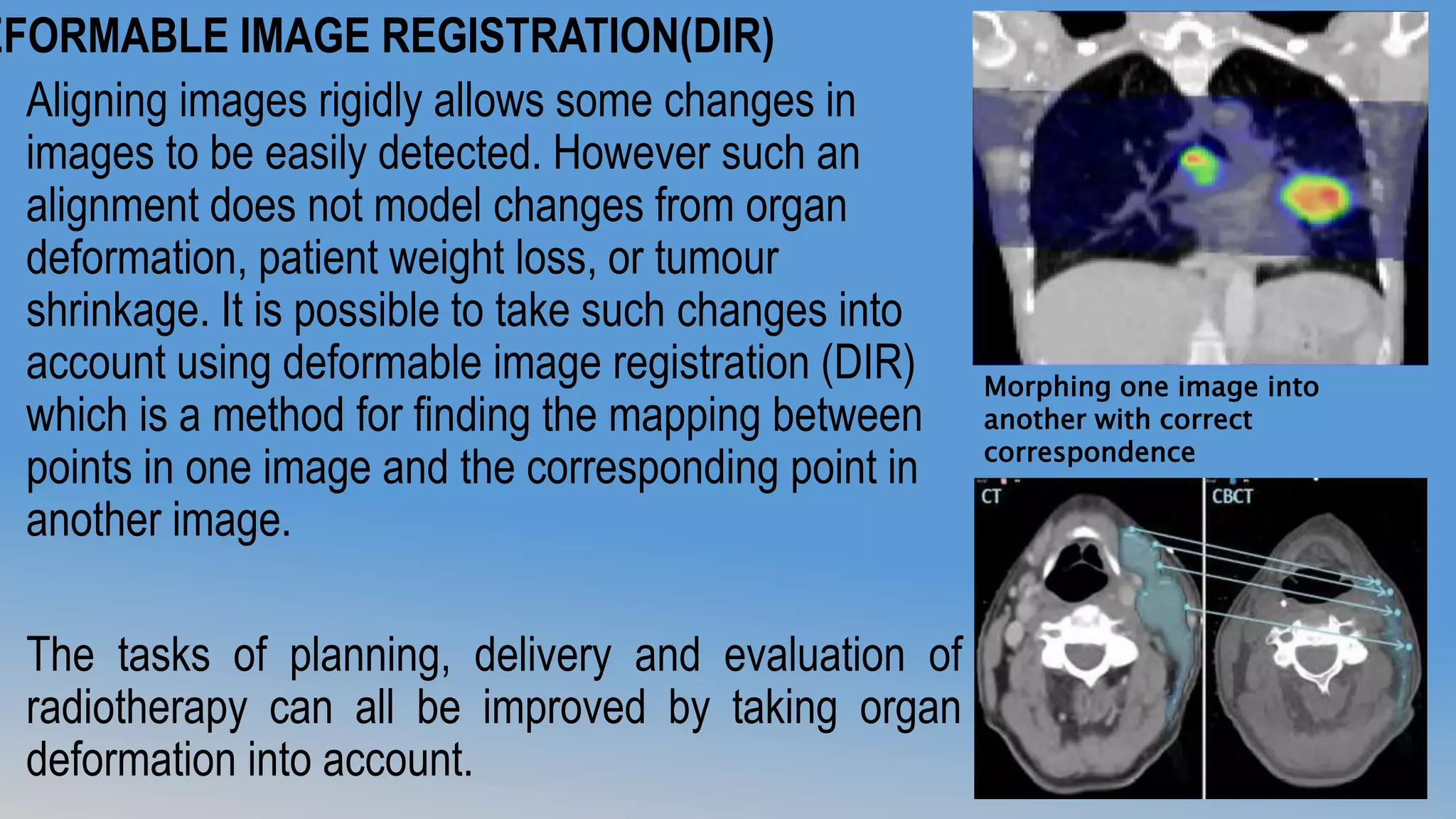 COMPLETE OVERVIEW ON ADAPTIVE RADIOTHERAPY OVER DAILY IMAGE GUIDED ...