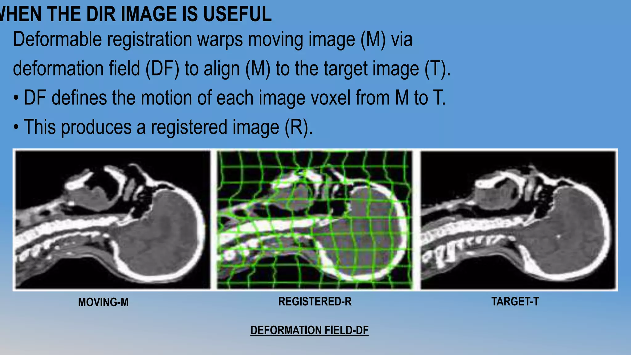 COMPLETE OVERVIEW ON ADAPTIVE RADIOTHERAPY OVER DAILY IMAGE GUIDED ...