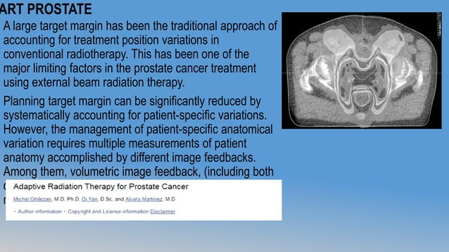 COMPLETE OVERVIEW ON ADAPTIVE RADIOTHERAPY OVER DAILY IMAGE GUIDED ...