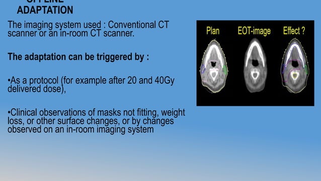 COMPLETE OVERVIEW ON ADAPTIVE RADIOTHERAPY OVER DAILY IMAGE GUIDED ... COMPLETE OVERVIEW ON ADAPTIVE RADIOTHERAPY OVER DAILY IMAGE GUIDED ...