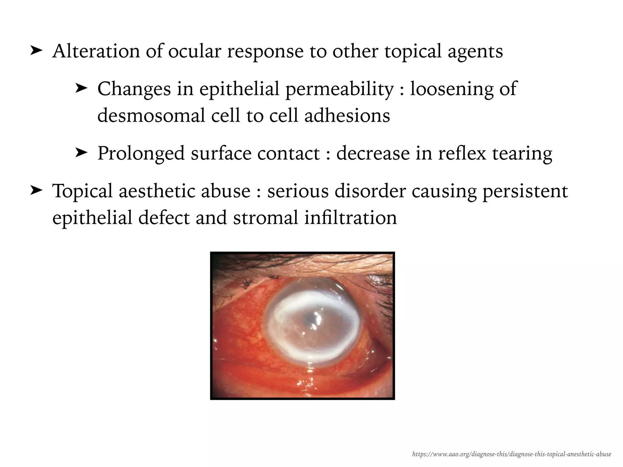 Adverse drug reactions ophthalmology | PDF