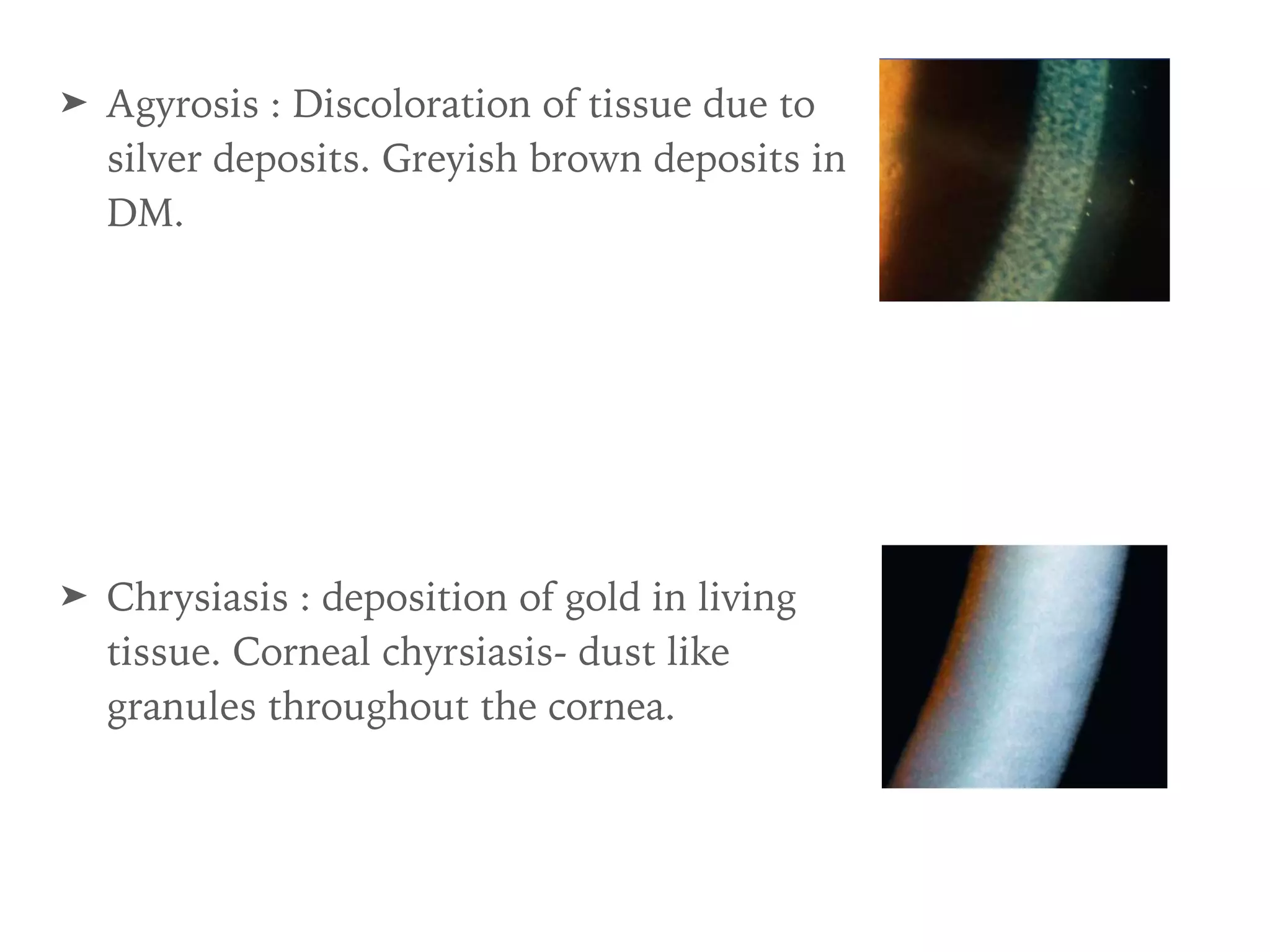 Adverse drug reactions ophthalmology | PDF