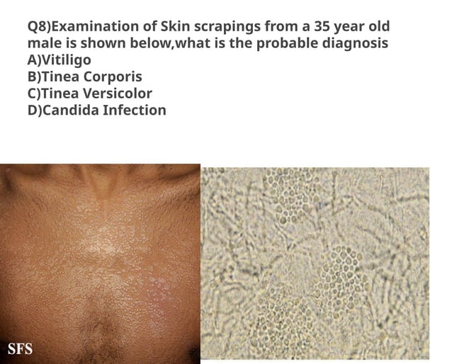 Dermatology adverse drug reactions .pptx