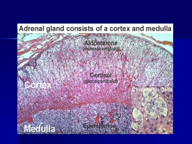 adrenal gland disorders ii-14 - Copy.ppt