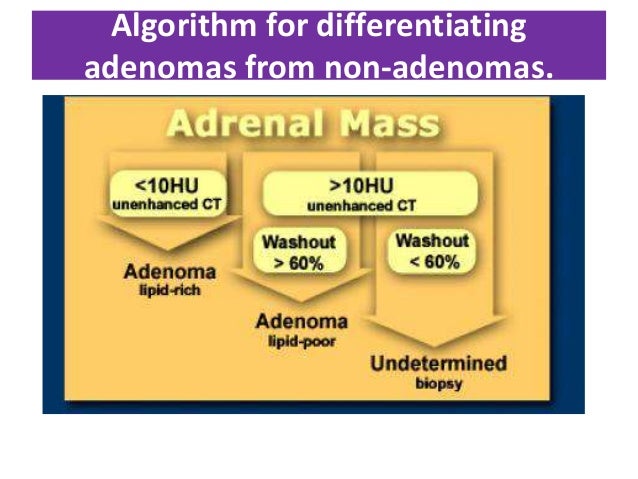 Adrenal Adenoma Radiology