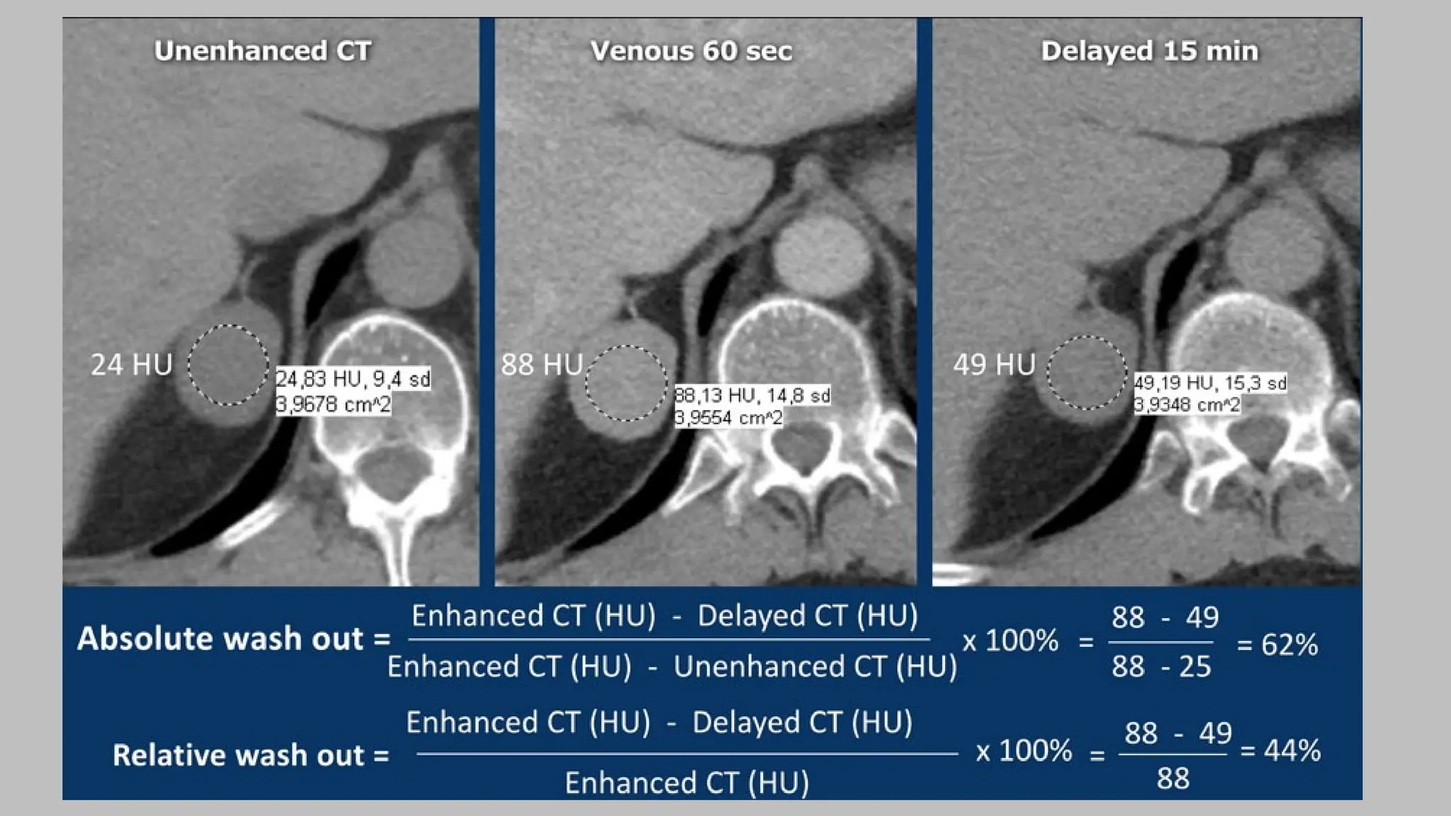 CT scan adrenal and pancreatic protocol.pptx