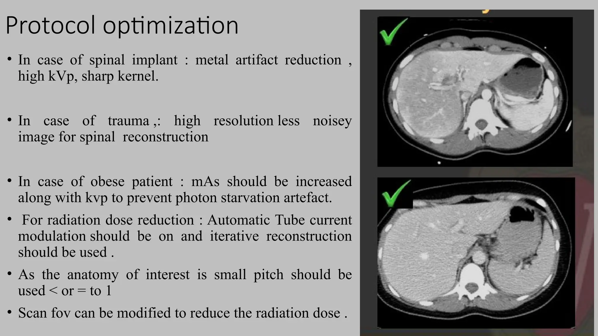 CT scan adrenal and pancreatic protocol.pptx