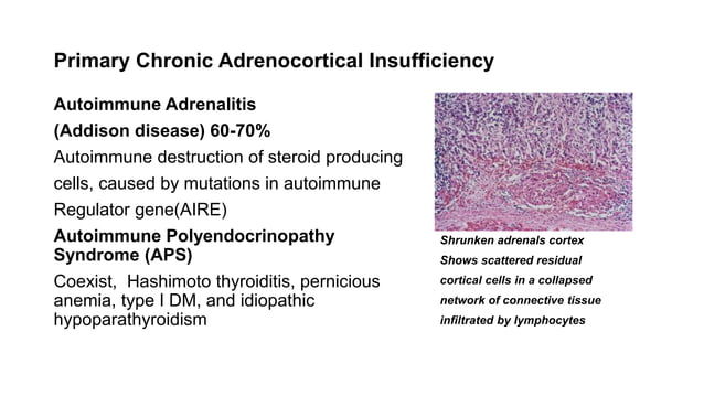 Adrenal cortical disorderspptx | PPT