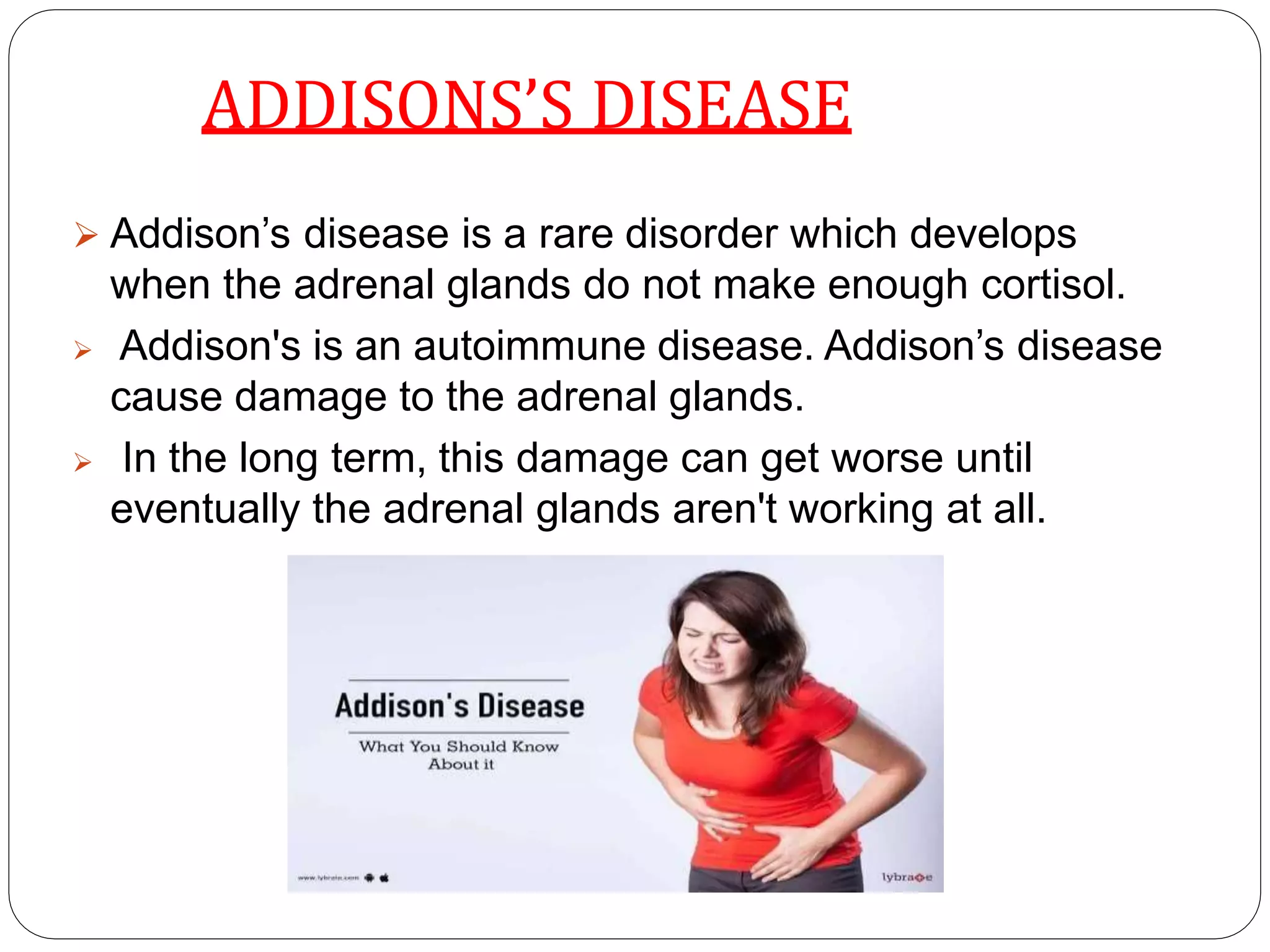 adrenal disorder.pptx