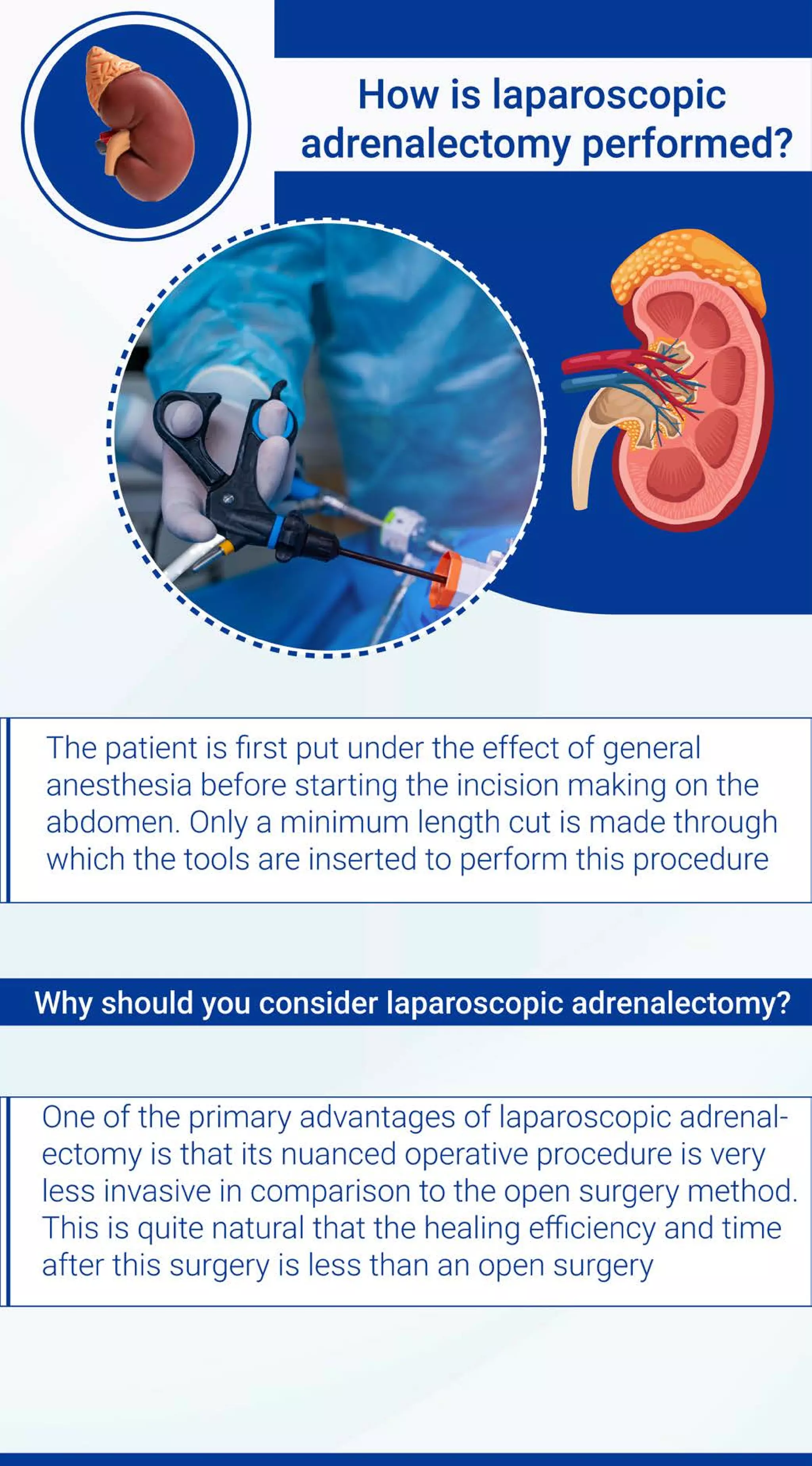 Adrenalectomy (Adrenal Gland) | PDF