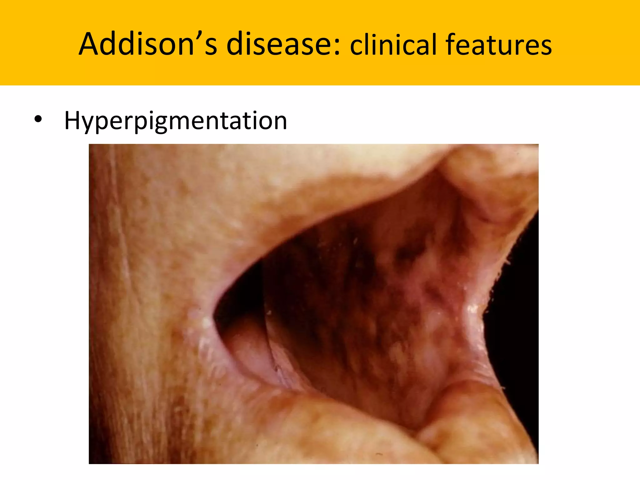 adrenal function tests.pptx