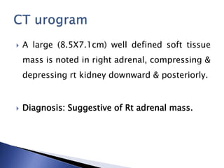A 16 year old girl with right loin pain due to Adrenal ganglioneuroma.pptx