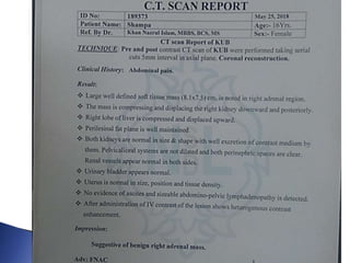 A 16 year old girl with right loin pain due to Adrenal ganglioneuroma.pptx