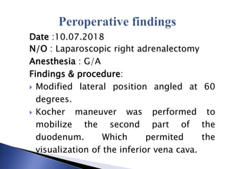 A 16 year old girl with right loin pain due to Adrenal ganglioneuroma.pptx