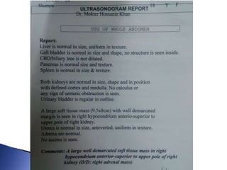 A 16 year old girl with right loin pain due to Adrenal ganglioneuroma.pptx