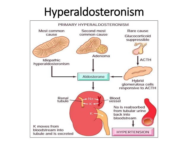 Adrenal Gland Diseases And Tumors