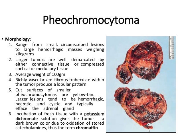 Adrenal Gland Diseases And Tumors
