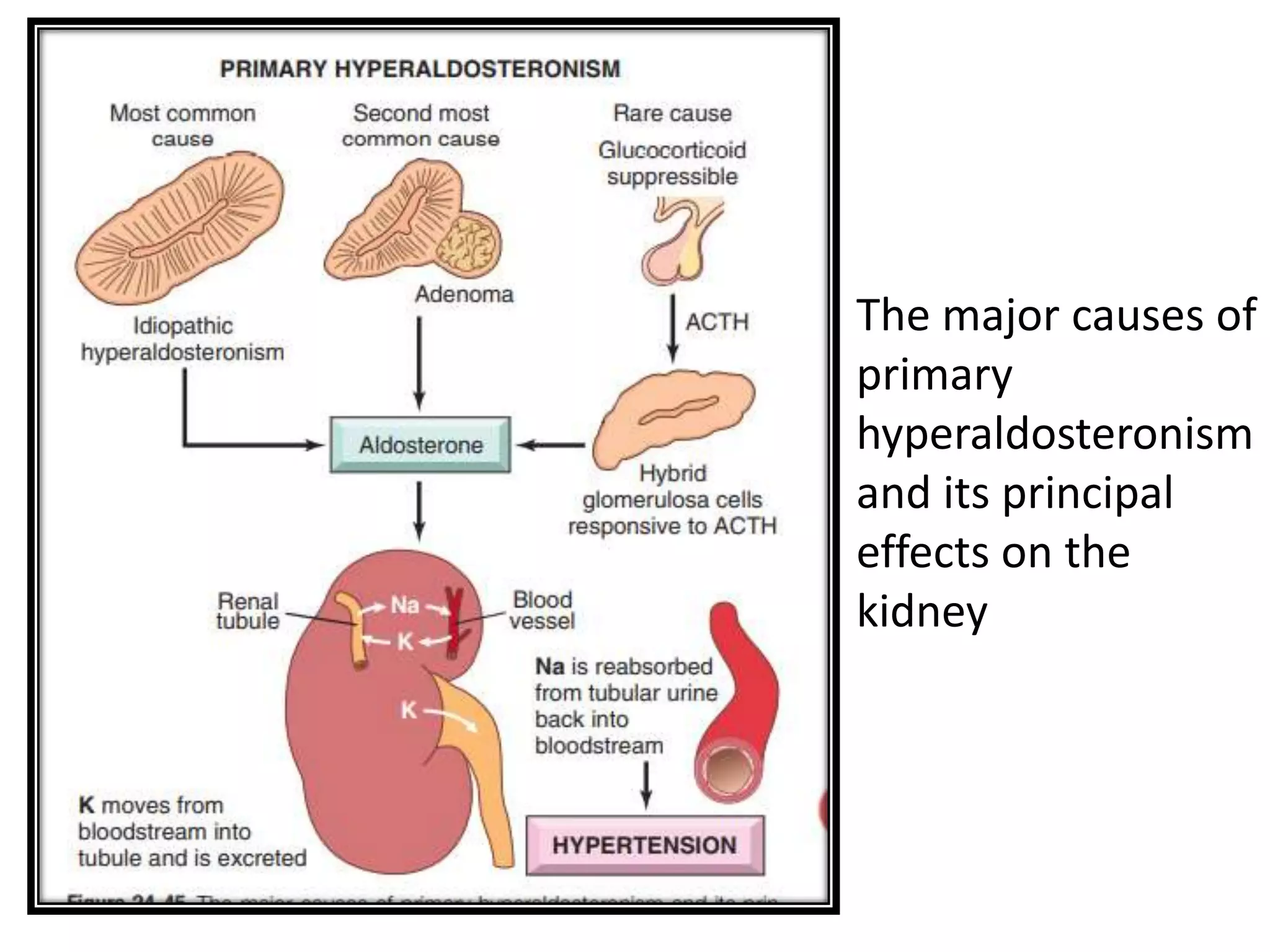 ADRENAL GLAND PATHOLOGY | PPTX