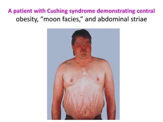 ADRENAL GLAND PATHOLOGY | PPTX