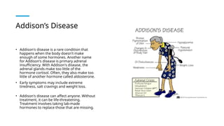 Presentation on the adrenal gland and its common functions | PPTX