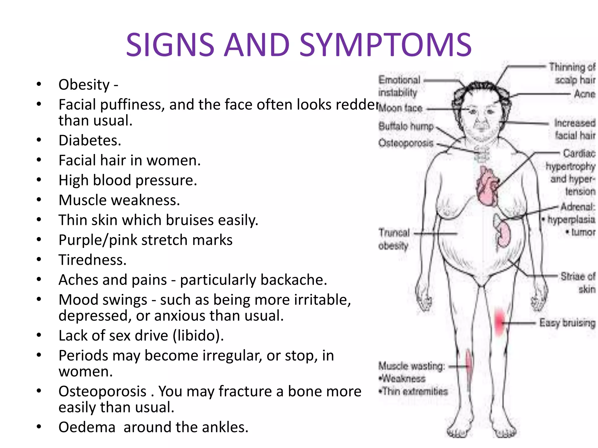 Adrenal Gland Disorders Pptx