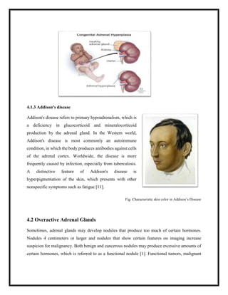 adrenal glands anatomy and physiology and funnction | DOCX