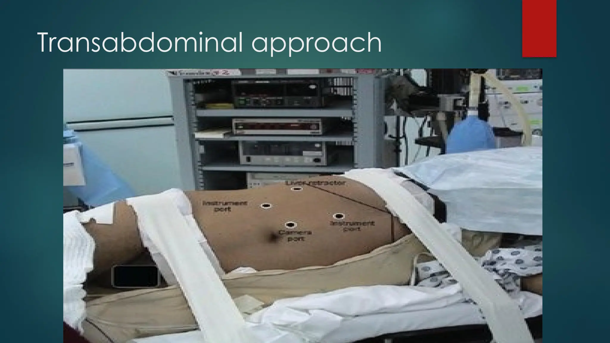 adrenal incidentaloma-1 approach and overview.pptx