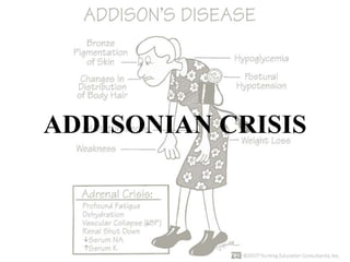 Adrenal insufficiency | PPTX