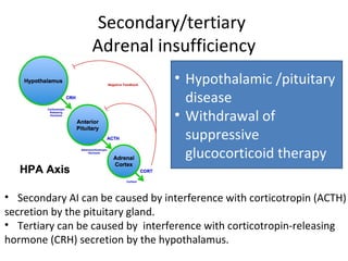 Disorder of Adrenal Gland: Adrenal insufficiency | PPT